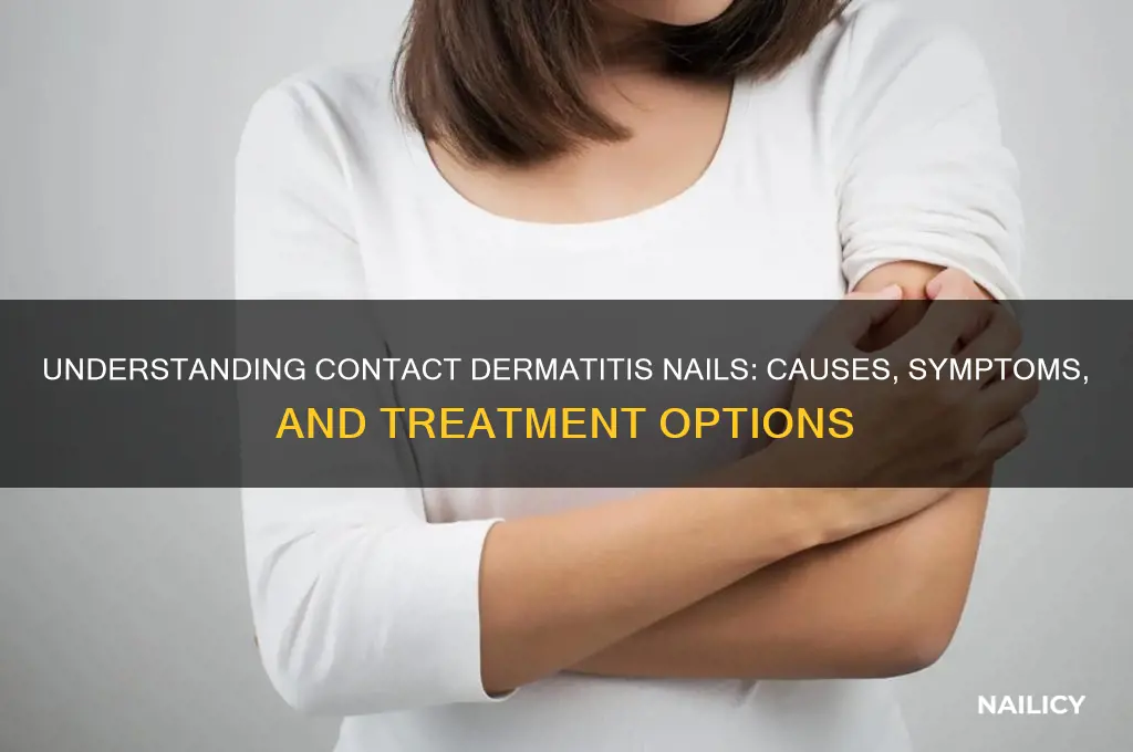 Understanding Contact Dermatitis Nails: Causes, Symptoms, And Treatment ...