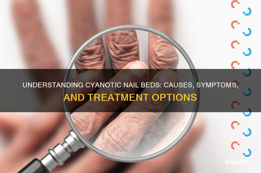 Understanding Cyanotic Nail Beds: Causes, Symptoms, And Treatment ...