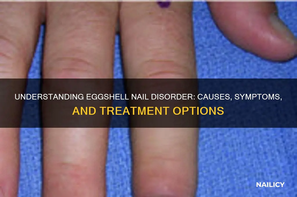 Understanding Eggshell Nail Disorder: Causes, Symptoms, And Treatment ...