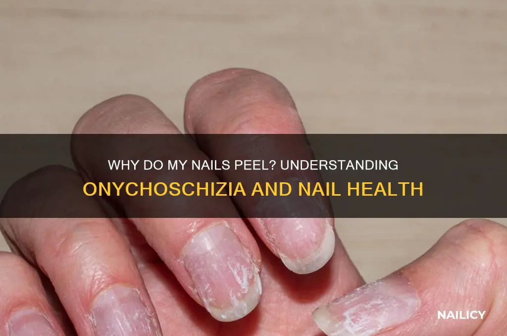 Why Do My Nails Peel? Understanding Onychoschizia And Nail Health | Nailicy