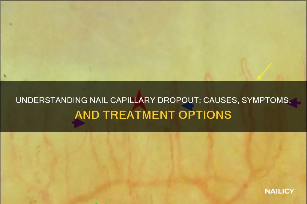 Understanding Nail Capillary Dropout: Causes, Symptoms, And Treatment ...