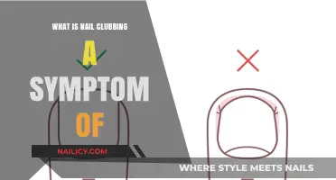 Understanding Nail Clubbing: Symptoms, Causes, And Underlying Health ...