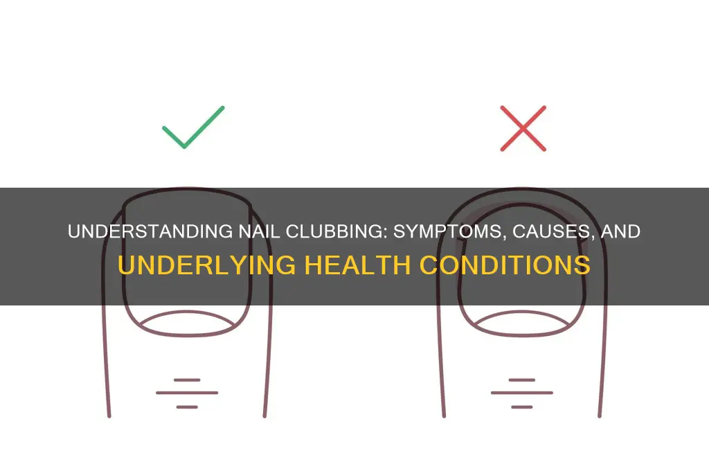 Understanding Nail Clubbing: Symptoms, Causes, And Underlying Health ...