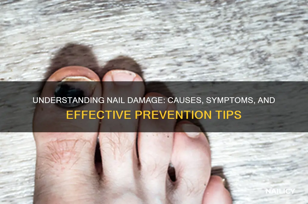 Understanding Nail Damage: Causes, Symptoms, And Effective Prevention ...
