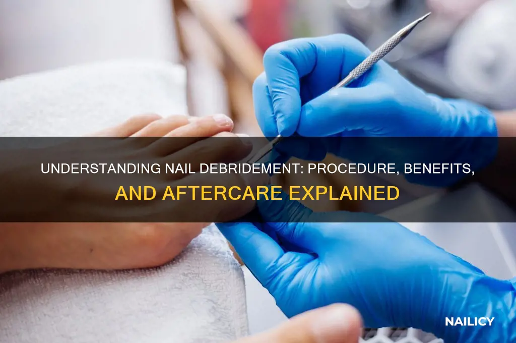 Understanding Nail Debridement: Procedure, Benefits, And Aftercare ...