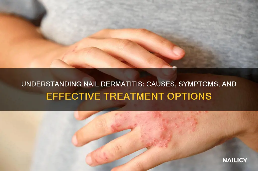 Understanding Nail Dermatitis: Causes, Symptoms, And Effective ...