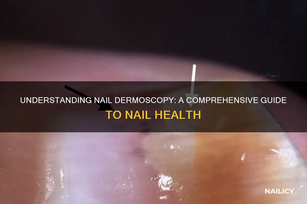 Understanding Nail Dermoscopy: A Comprehensive Guide To Nail Health ...