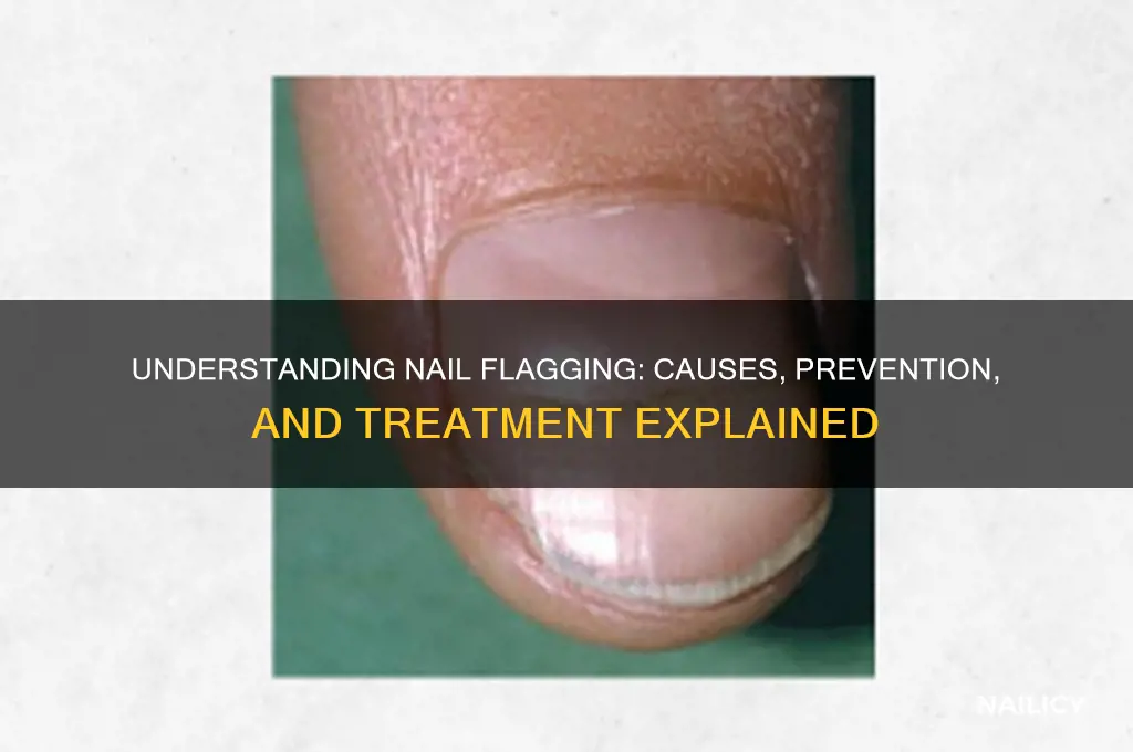 Understanding Nail Flagging: Causes, Prevention, And Treatment ...
