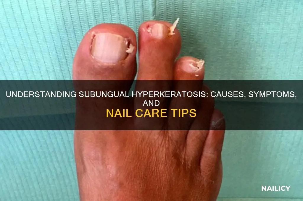 Understanding Subungual Hyperkeratosis: Causes, Symptoms, And Nail Care ...
