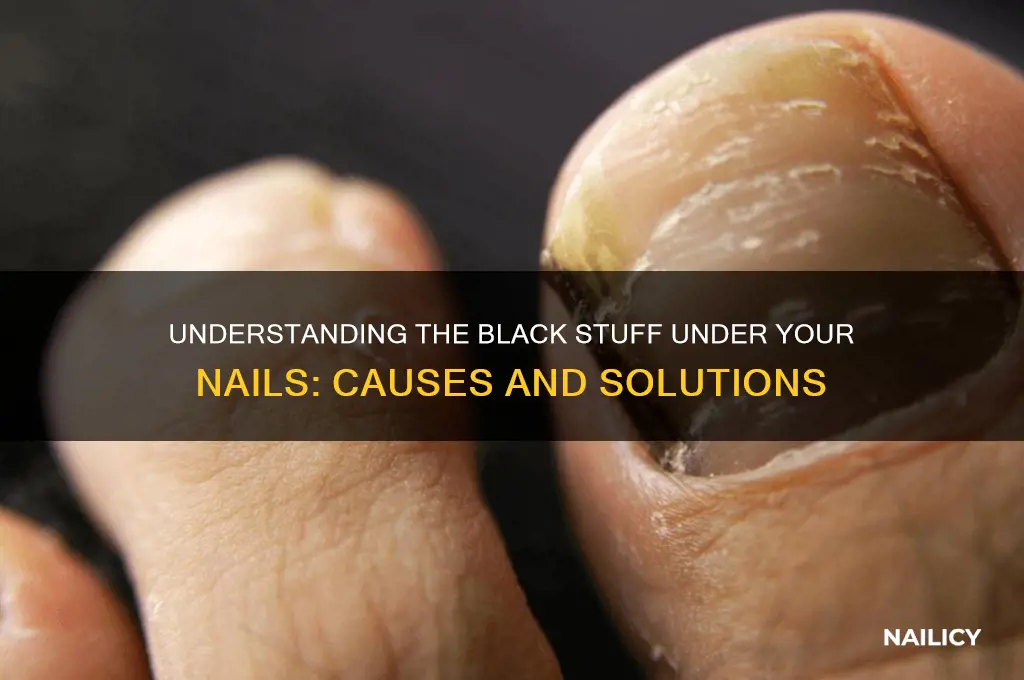 Understanding The Black Stuff Under Your Nails: Causes And Solutions ...