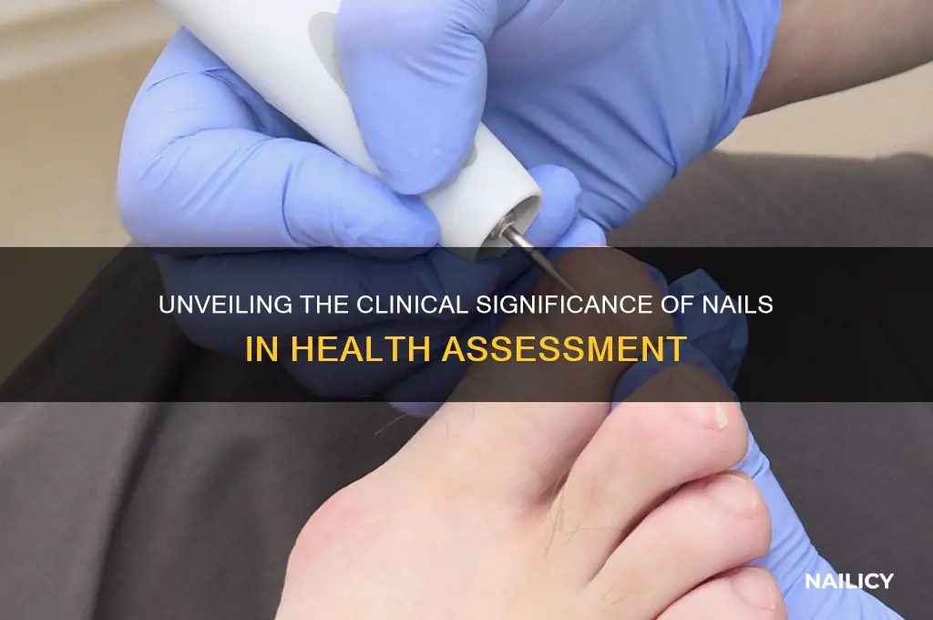 Unveiling The Clinical Significance Of Nails In Health Assessment | Nailicy