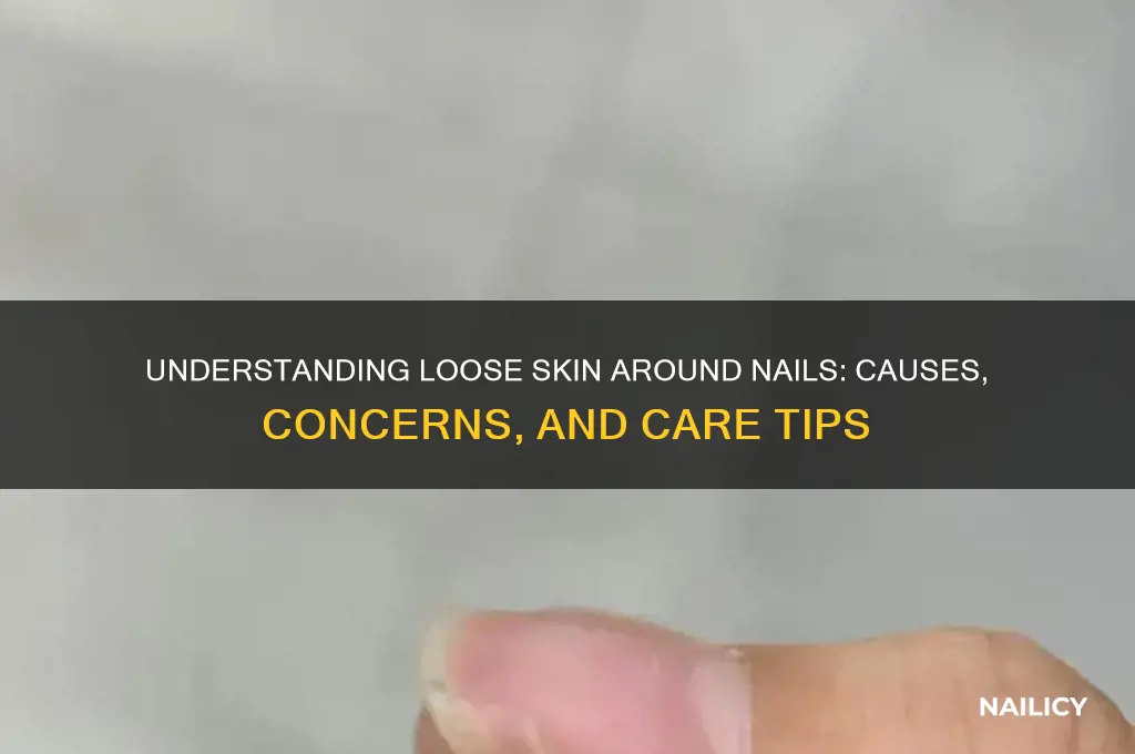 Understanding Loose Skin Around Nails: Causes, Concerns, And Care Tips ...