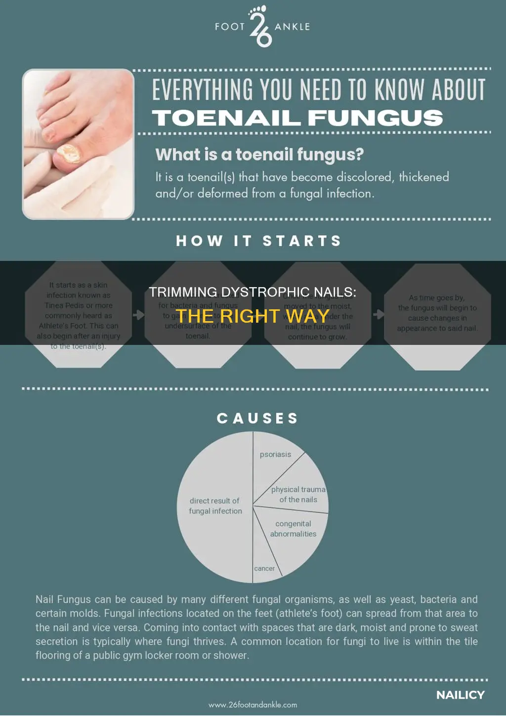Trimming Dystrophic Nails: The Right Way | Nailicy