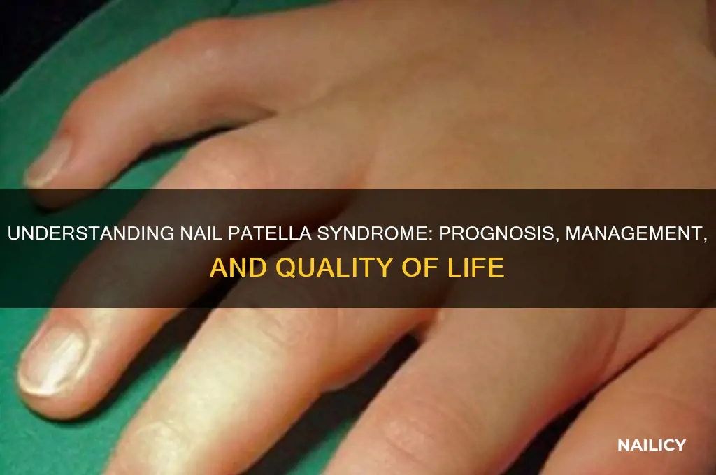 Understanding Nail Patella Syndrome: Prognosis, Management, And Quality ...