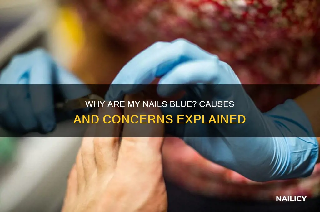 Why Are My Nails Blue? Causes And Concerns Explained | Nailicy
