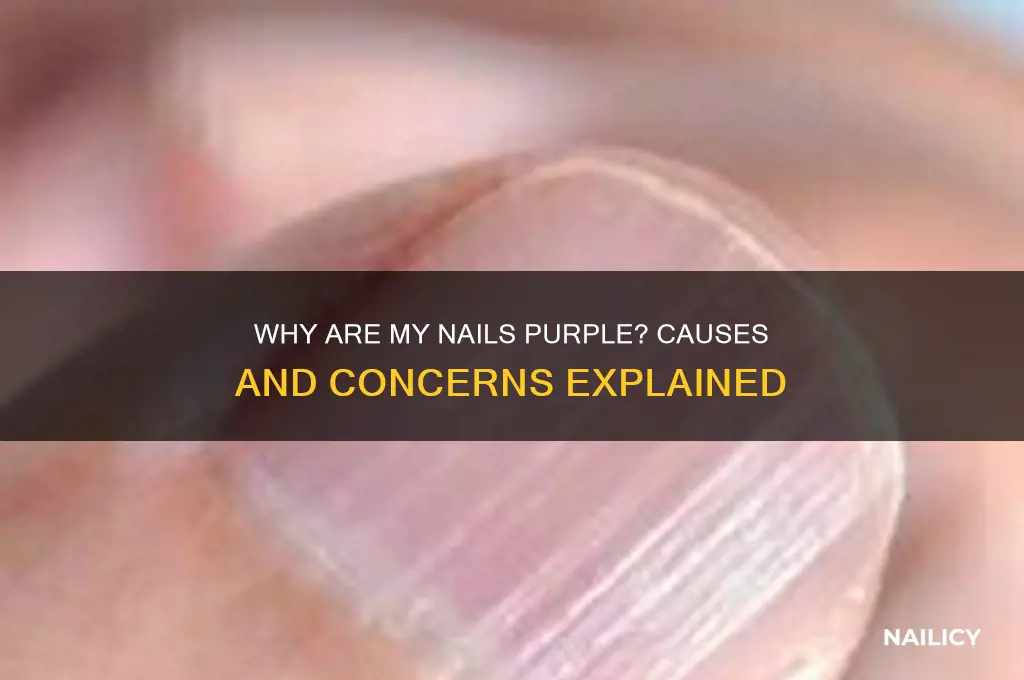 Why Are My Nails Purple? Causes And Concerns Explained | Nailicy