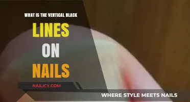 Understanding Vertical Black Lines On Nails: Causes And Concerns | Nailicy