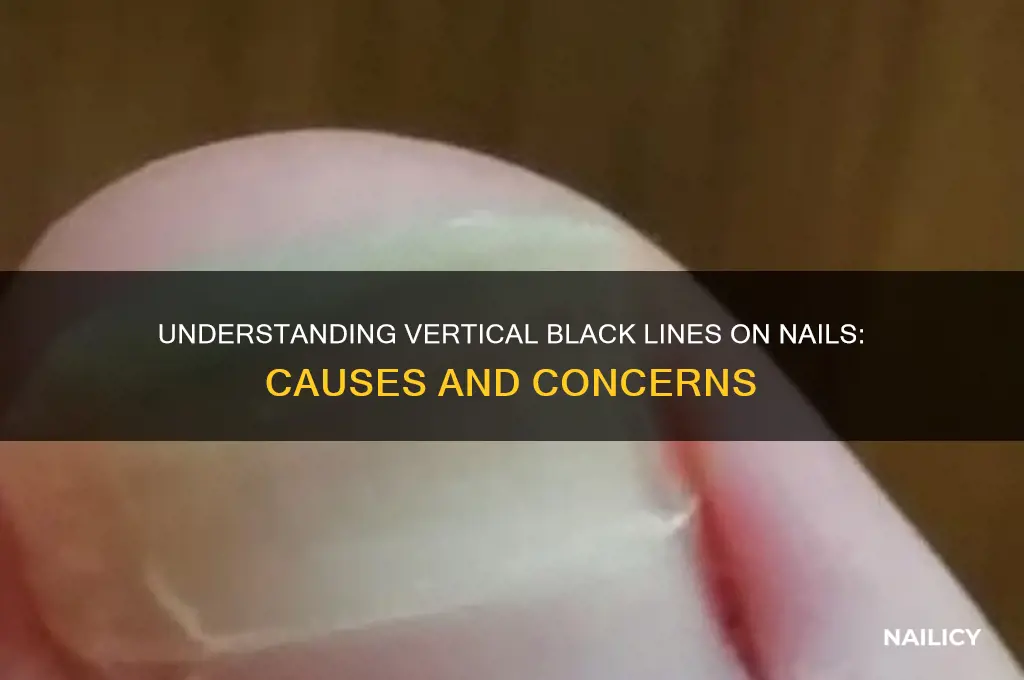 Understanding Vertical Black Lines On Nails: Causes And Concerns | Nailicy