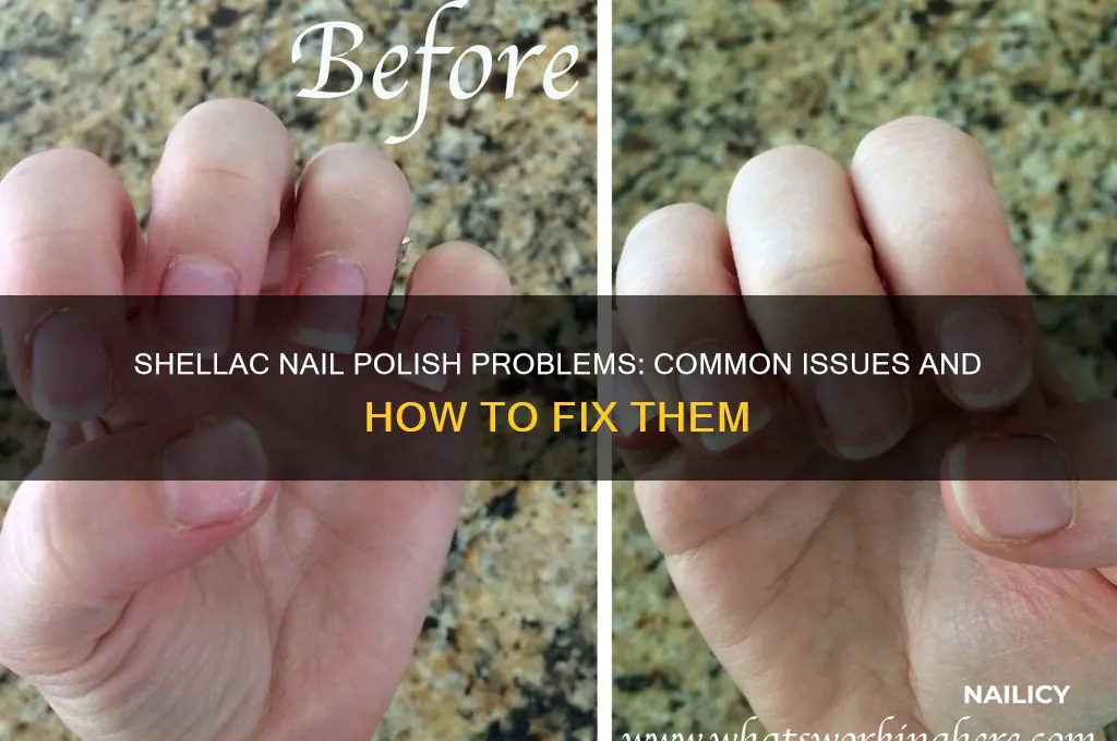 Shellac Nail Polish Problems: Common Issues And How To Fix Them | Nailicy