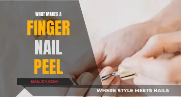 Understanding Pain Under Fingernails: Causes And Treatment | Nailicy