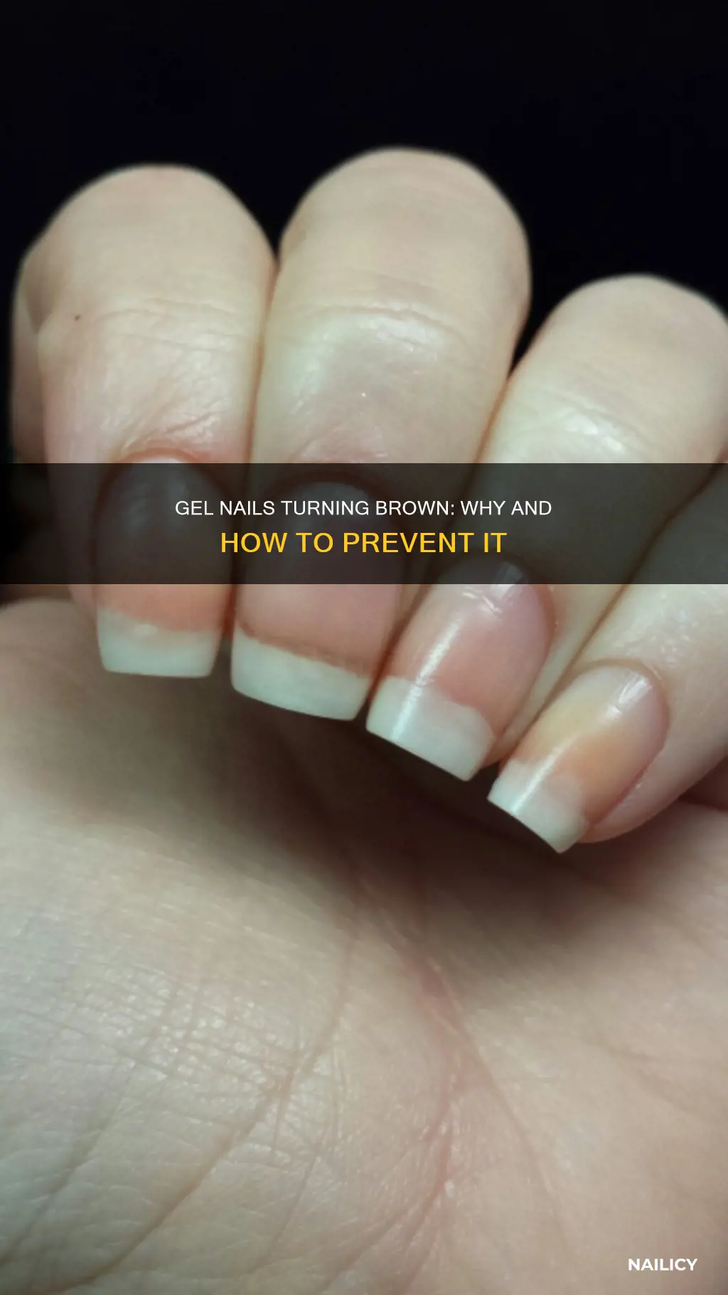 Gel Nails Turning Brown: Why And How To Prevent It | Nailicy