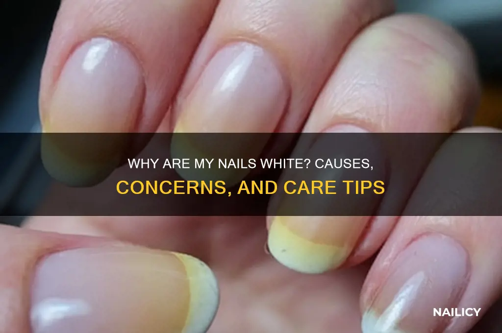 Why Are My Nails White? Causes, Concerns, And Care Tips | Nailicy