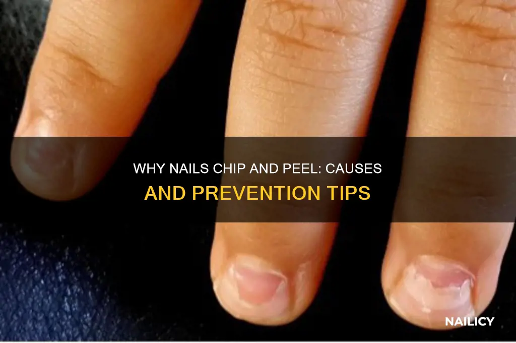 Why Nails Chip And Peel: Causes And Prevention Tips | Nailicy