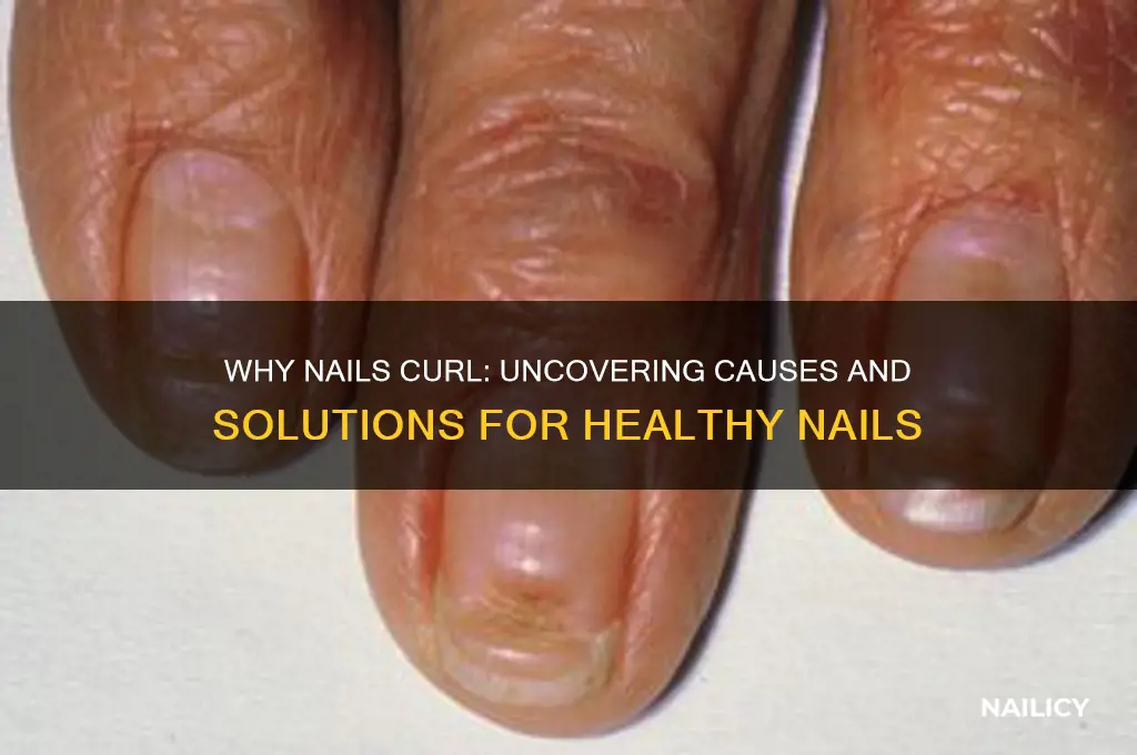 Why Nails Curl: Uncovering Causes And Solutions For Healthy Nails | Nailicy