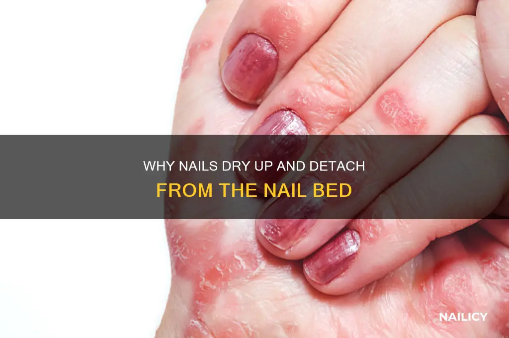 Why Nails Dry Up And Detach From The Nail Bed | Nailicy