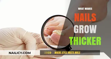 Understanding Rippled Nails: Causes, Concerns, And Effective Solutions ...
