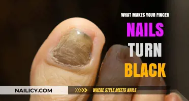 Why Do Nails Change Color? Uncovering The Surprising Causes And ...