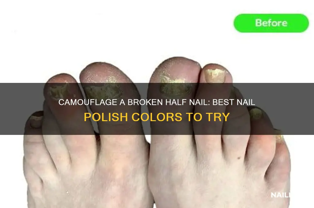 Camouflage A Broken Half Nail: Best Nail Polish Colors To Try | Nailicy