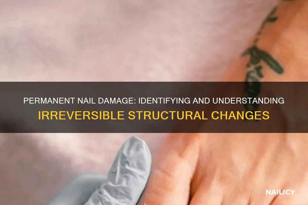 Permanent Nail Damage: Identifying And Understanding Irreversible ...
