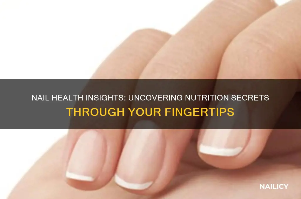 Nail Health Insights: Uncovering Nutrition Secrets Through Your ...
