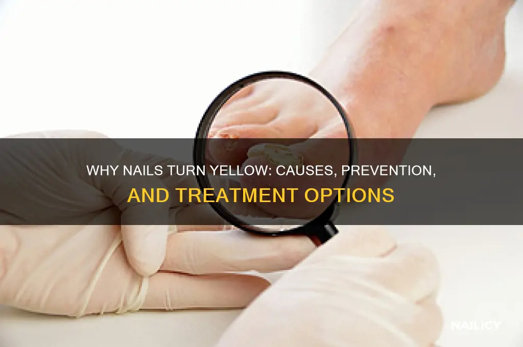 Why Nails Turn Yellow: Causes, Prevention, And Treatment Options | Nailicy