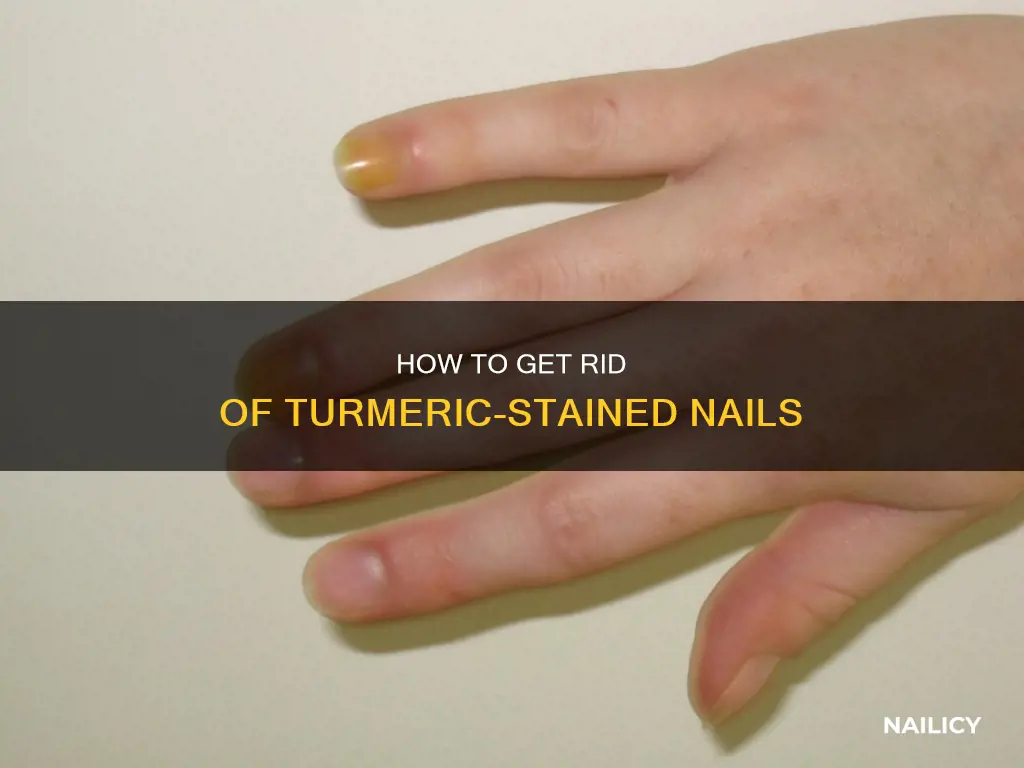 How To Get Rid Of Turmeric-Stained Nails | Nailicy