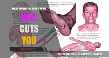 Healing Cuts Near Nails: Quick And Easy Methods | Nailicy