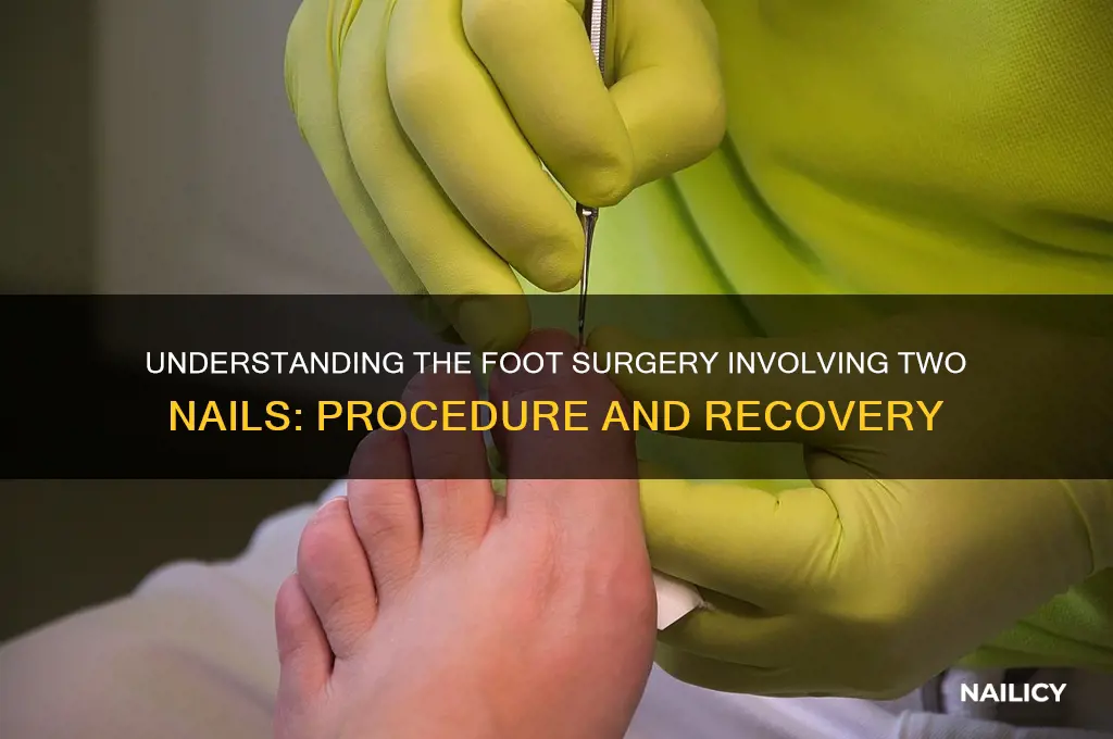 Understanding The Foot Surgery Involving Two Nails: Procedure And ...