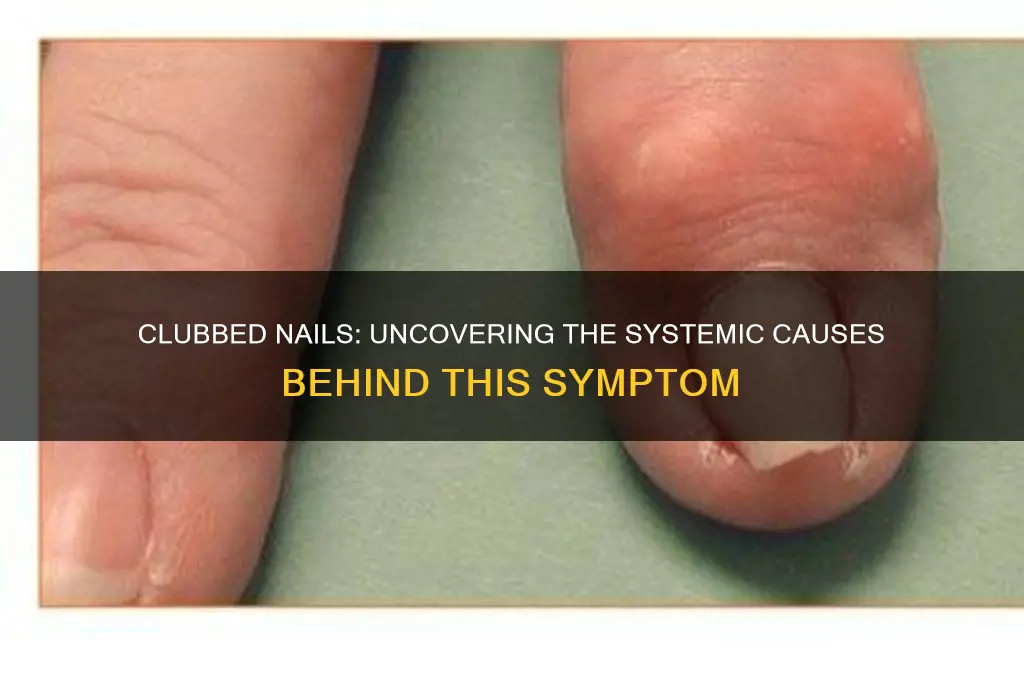 Clubbed Nails: Uncovering The Systemic Causes Behind This Symptom | Nailicy
