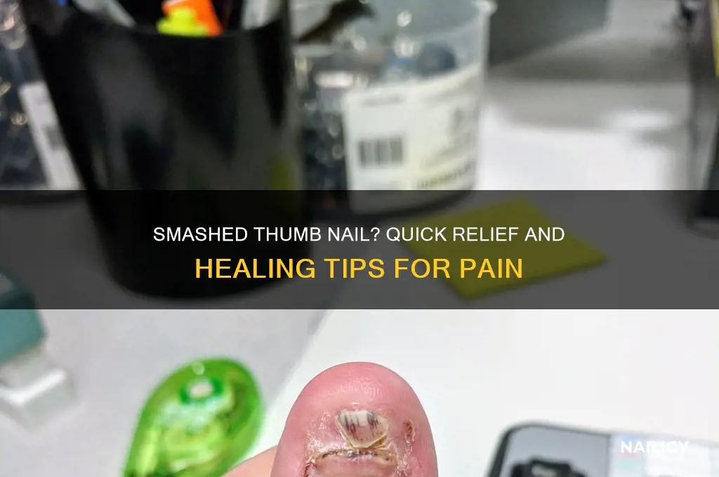 Smashed Thumb Nail? Quick Relief And Healing Tips For Pain | Nailicy