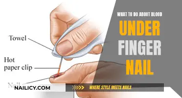 Reviving Dead Fingernails: A Quick Guide To Nail Care | Nailicy