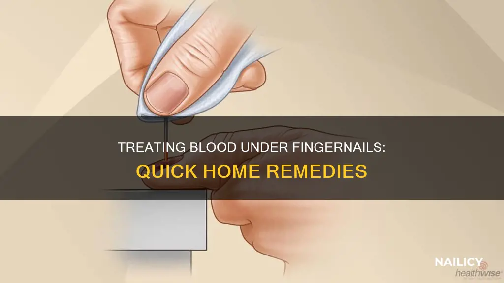 Treating Blood Under Fingernails: Quick Home Remedies | Nailicy