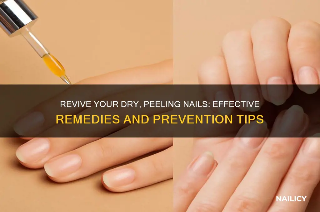 Revive Your Dry, Peeling Nails: Effective Remedies And Prevention Tips ...