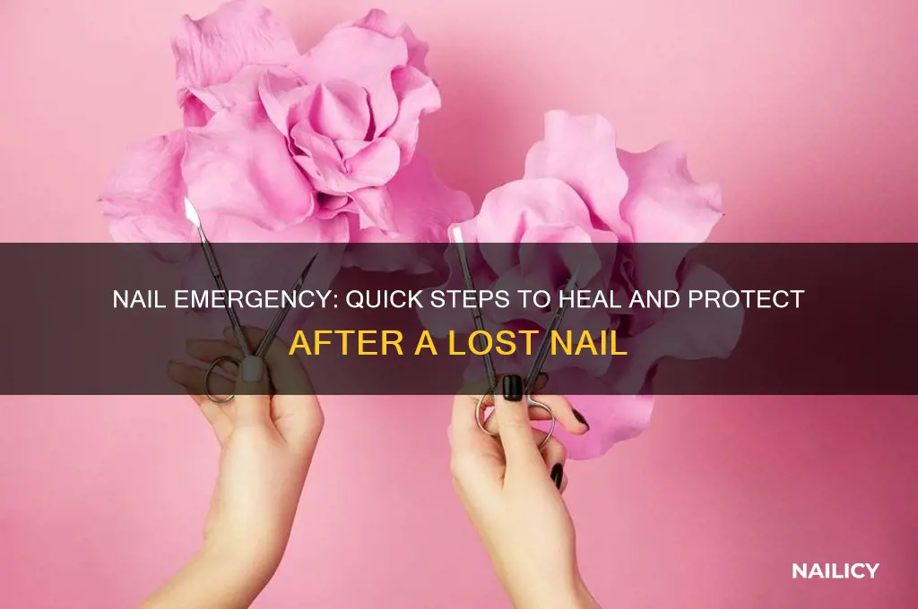 Nail Emergency: Quick Steps To Heal And Protect After A Lost Nail | Nailicy