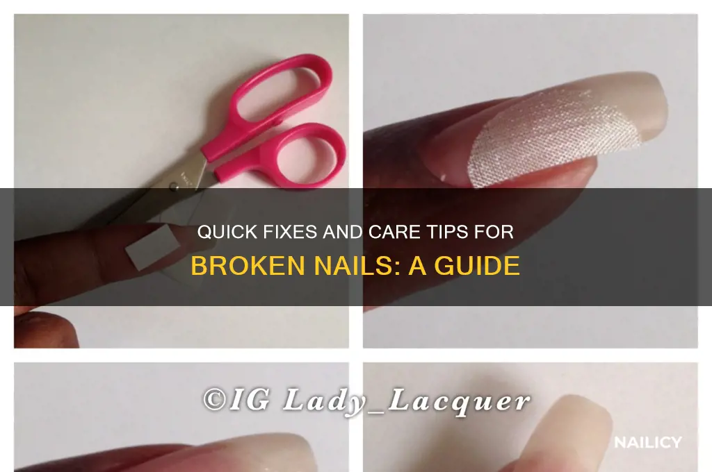 Quick Fixes And Care Tips For Broken Nails: A Guide | Nailicy
