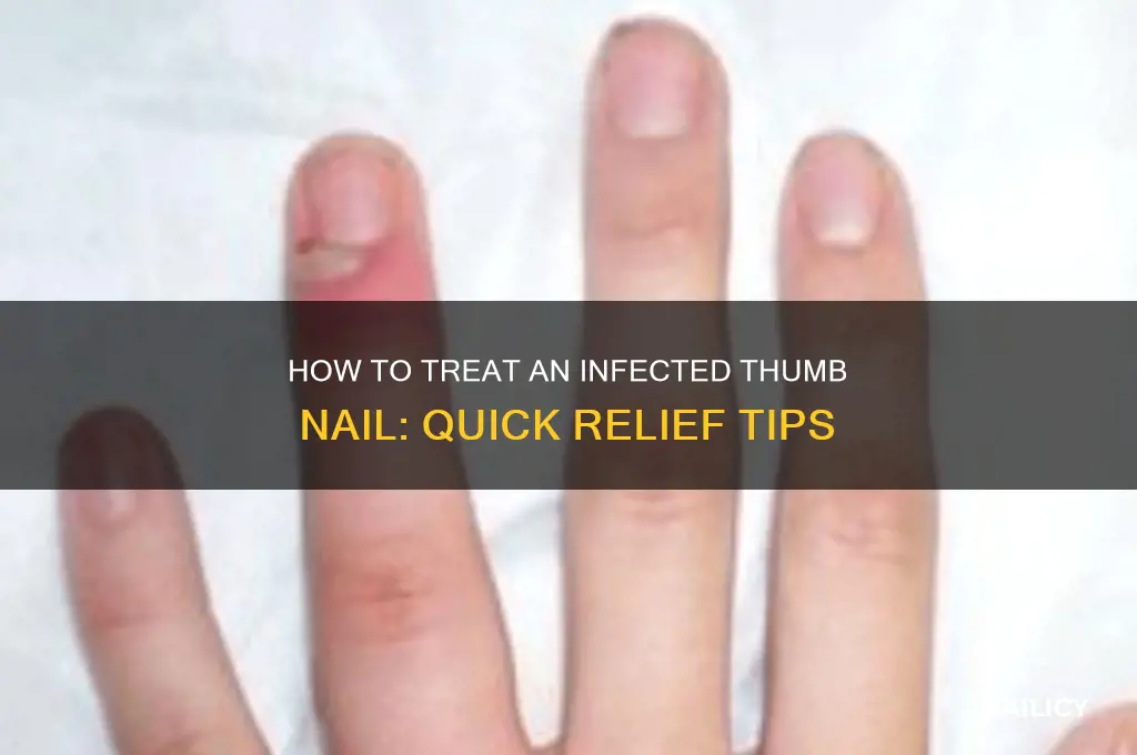 How To Treat An Infected Thumb Nail: Quick Relief Tips | Nailicy