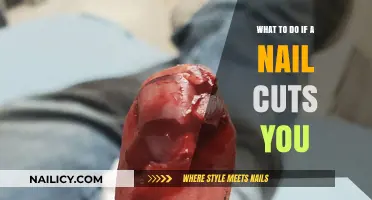 Treating Cuts From Rusty Nails: What You Need To Know | Nailicy
