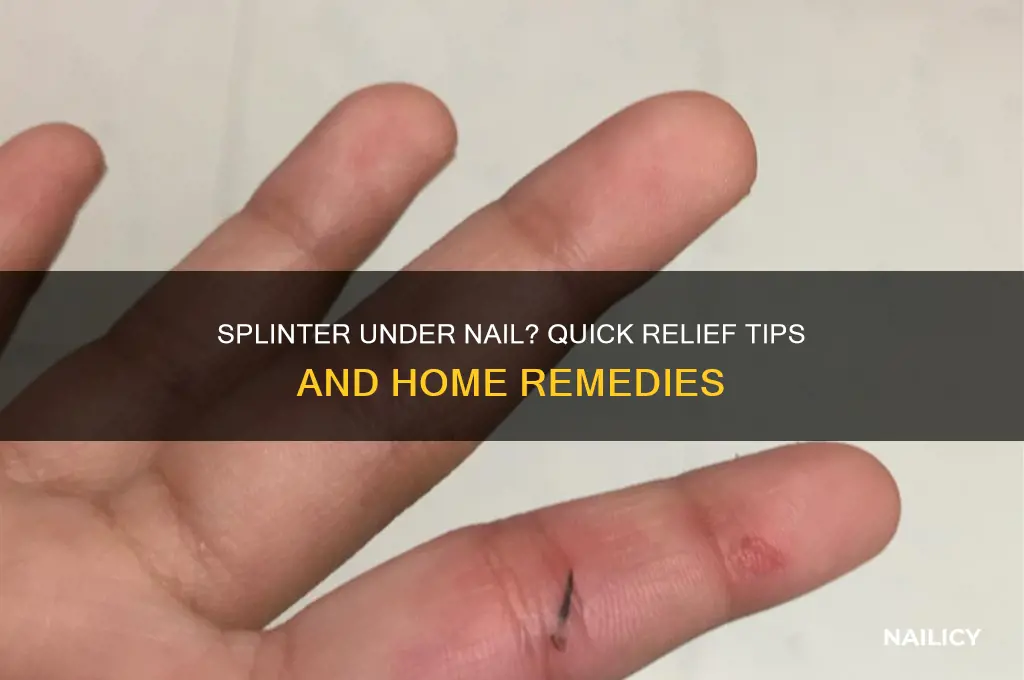 Splinter Under Nail? Quick Relief Tips And Home Remedies | Nailicy