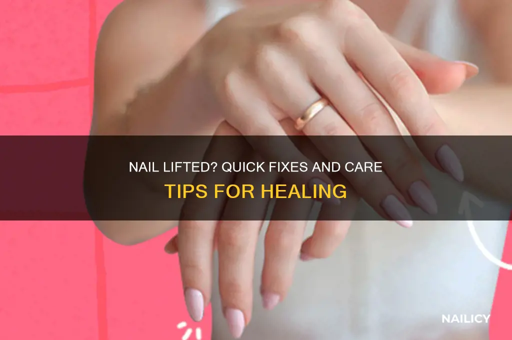 Nail Lifted? Quick Fixes And Care Tips For Healing | Nailicy