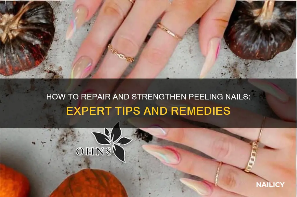 How To Repair And Strengthen Peeling Nails: Expert Tips And Remedies ...